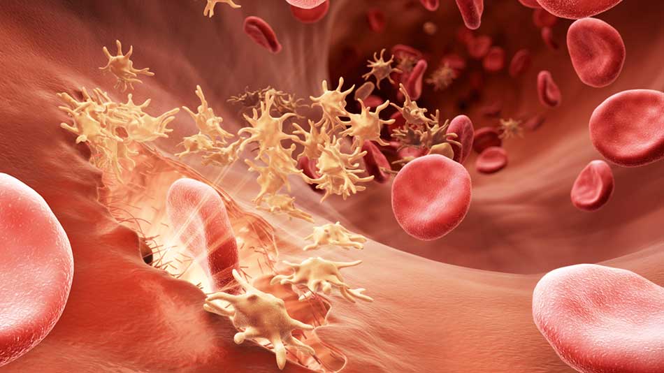 FDA Supports Hemophilia A Treatment ACE910